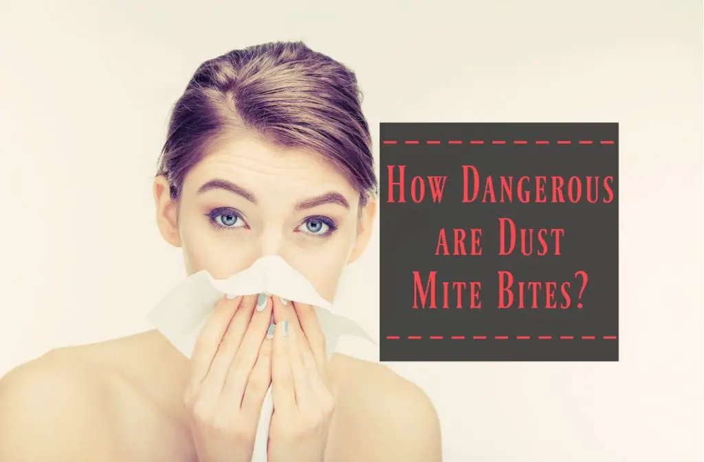 How Dangerous are Dust Mite Bites? When to See a Doctor? - The Healthy ...