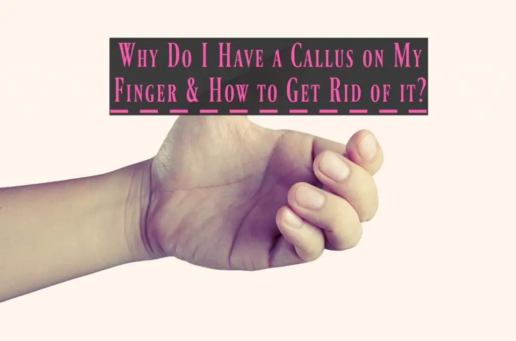 Why Do I Have a Callus on My Finger & How to Get Rid of it? - The ...
